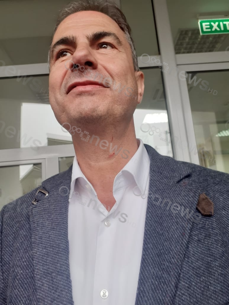 Elbasan/ konflikt fizik mes kandidatit Luçiano Boçi dhe biznesmenit ...